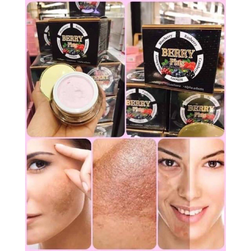 Jual Berry plus extra whitening night cream ( For dark spots & acne ...