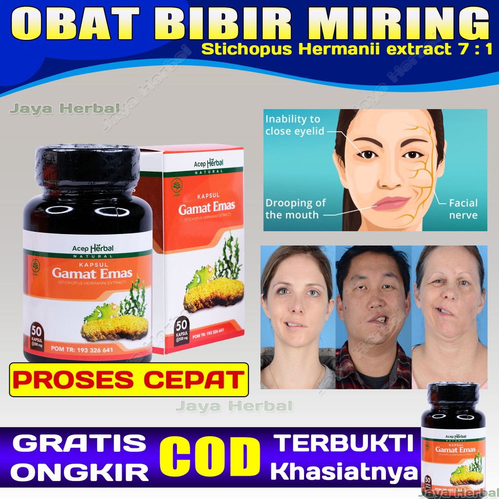 Jual Obat Bibir Miring Muka Mencong Sebelah Kanan Kiri Bells Palsy Stroke Ringan Stroke