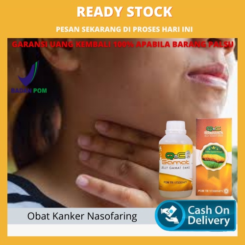 Jual Obat Tumor Nasofaring, Kanker Nasofaring, Obat Tumor Ganas Di ...