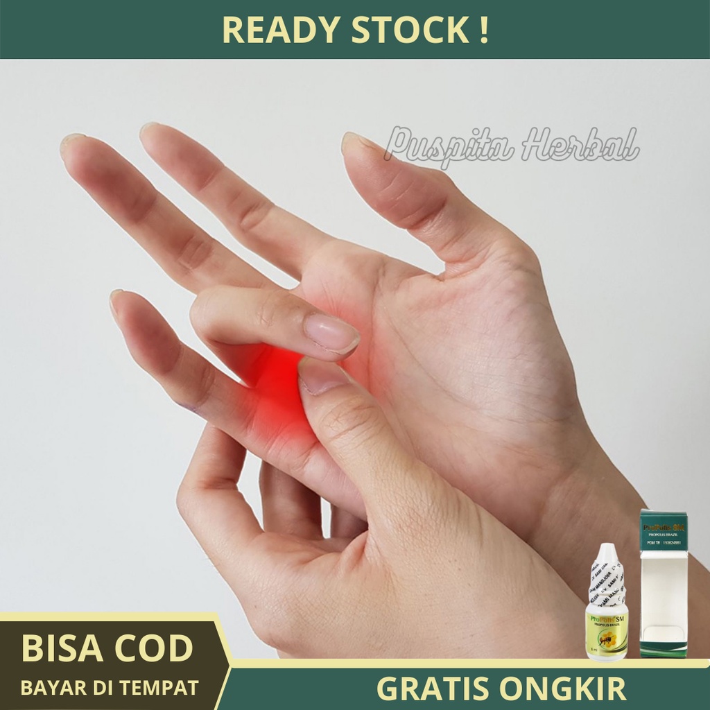 Jual Obat Jari Pelatuk, Trigger Finger, Kram Otot, Kesemutan, Kebas ...