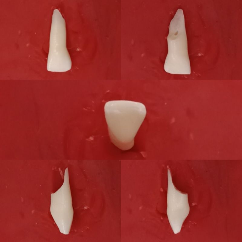 Jual Gigi 62 Pedo Anak Gigi Asli Praktikum Gigi Insisif Lateral Kiri ...