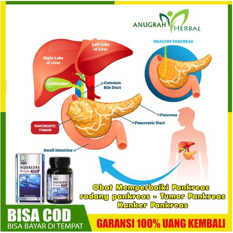 Jual Obat Memperbaiki Pankreas / radang pankreas - Tumor Pankreas ...
