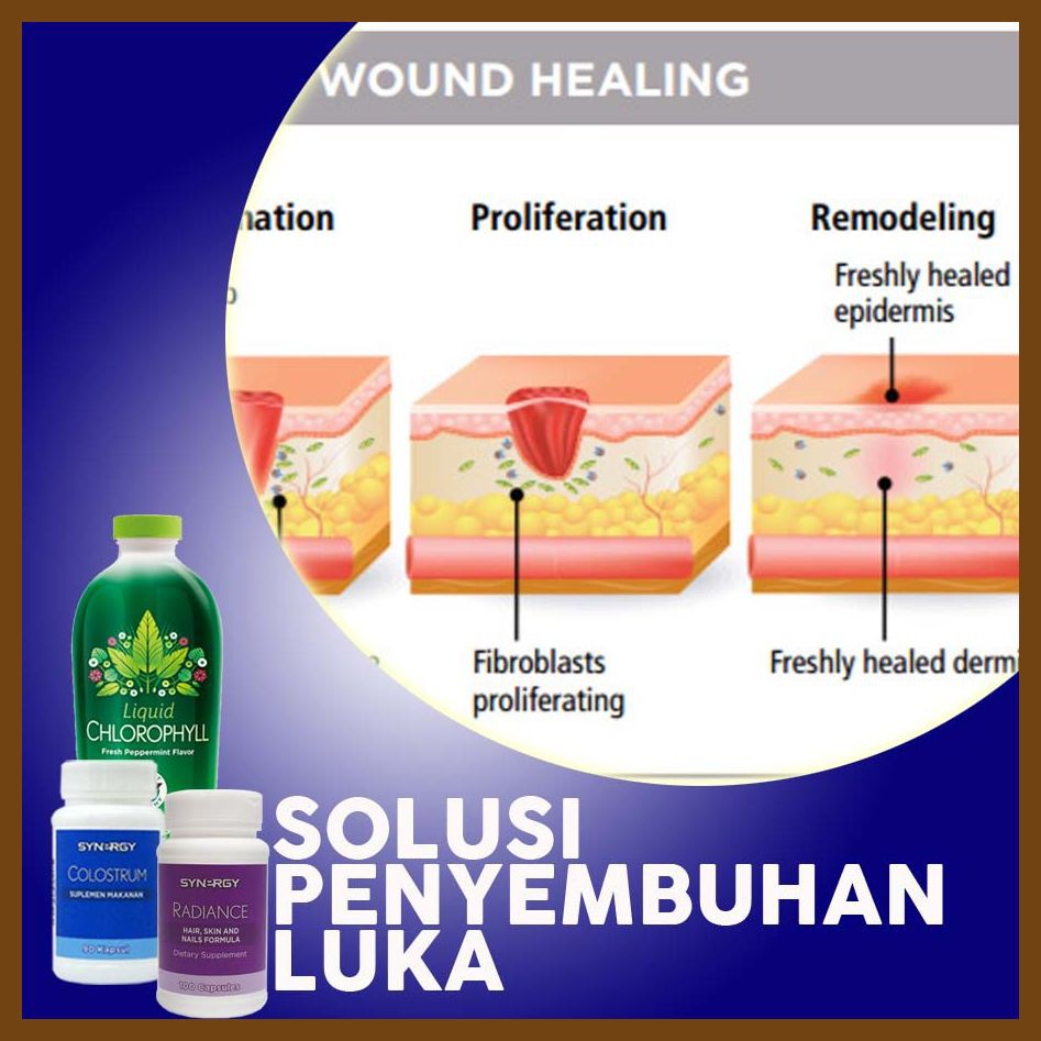 Jual Paket Perawatan Luka Sobek/Laserasi Luka Sayat RESMI BPOM | Shopee ...