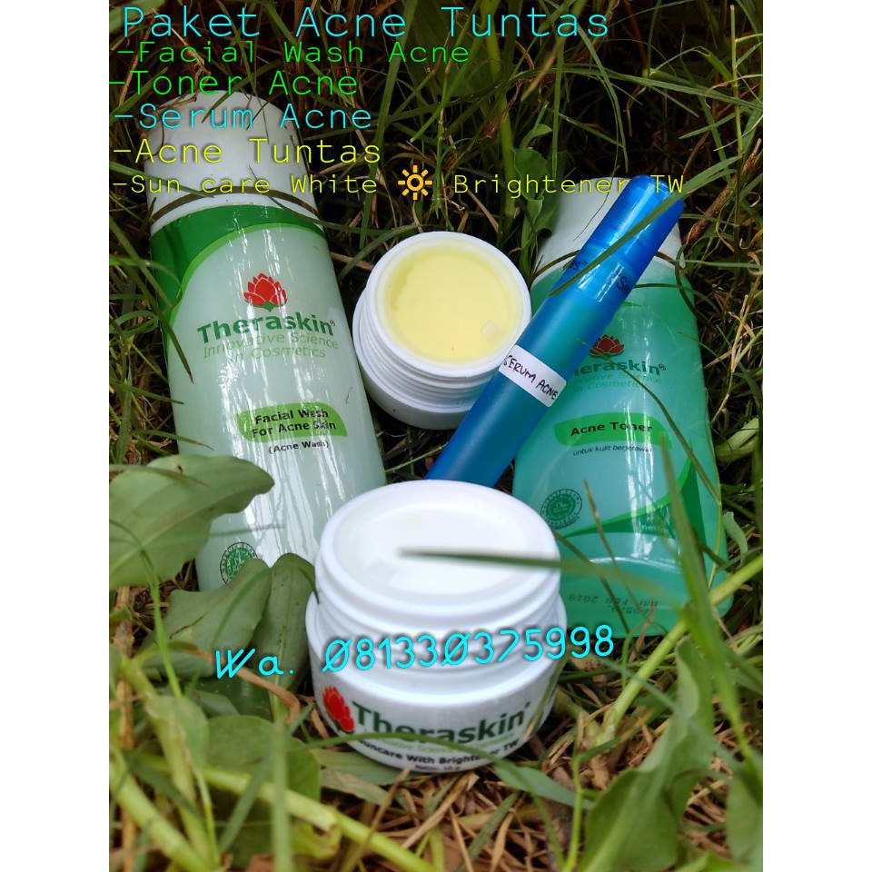 Jual Paket acne sedang/kecil ( Acne tuntas ) | Shopee Indonesia