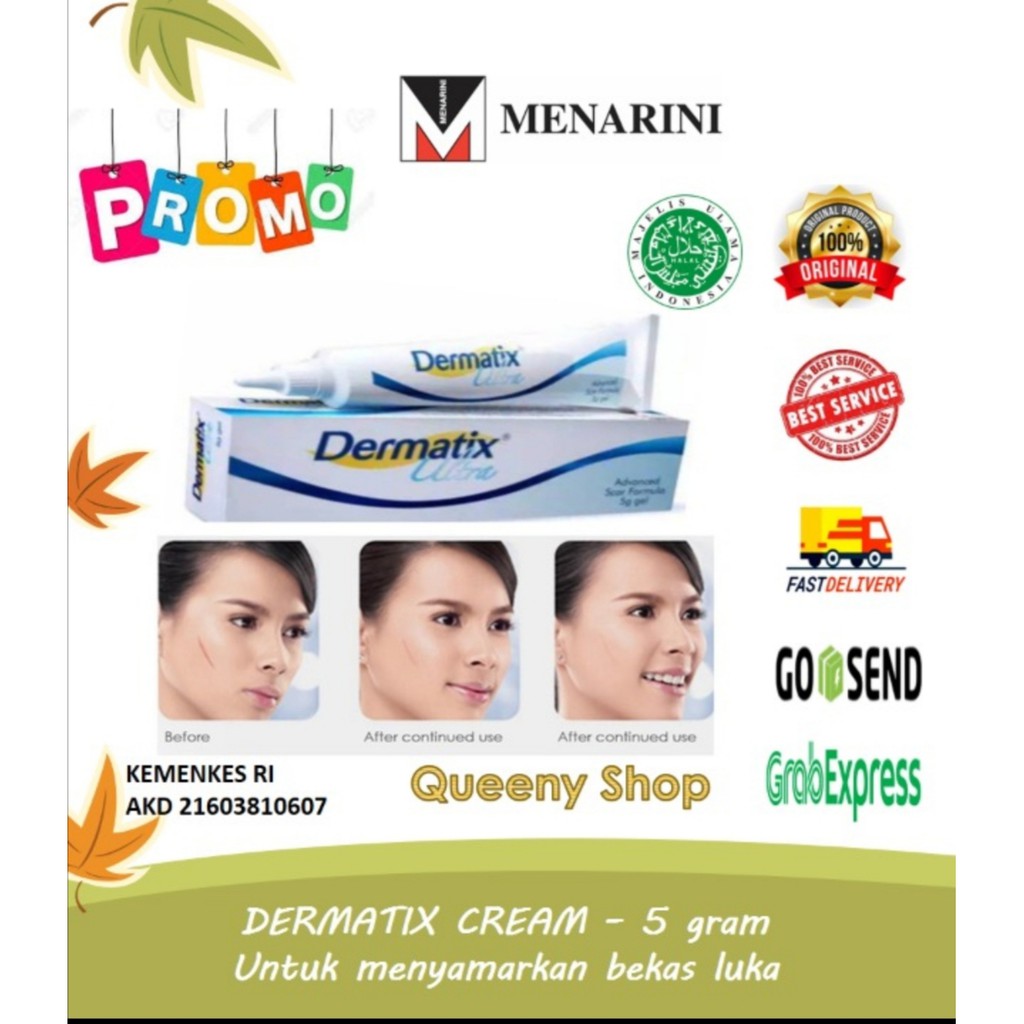 Jual DERMATIX ULTRA | Untuk Menyamarkan Bekas Luka Pada Kulit & Stretch ...
