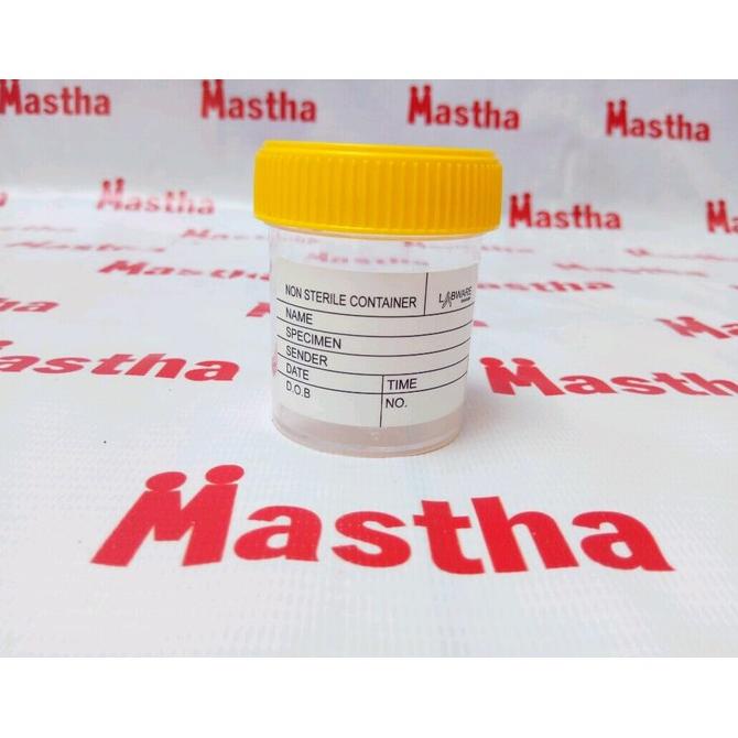 Jual Urine Container 60 ml / Tempat Sampel Urine | Shopee Indonesia