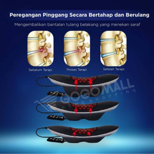 Jual Dr Qyu Lumbar Traction Device Terapi Nyeri Pinggang Saraf Kejepit | Shopee Indonesia