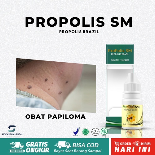 Jual Obat Papiloma Leher, Penghilang Papiloma Leher, Obat Kutil Leher ...