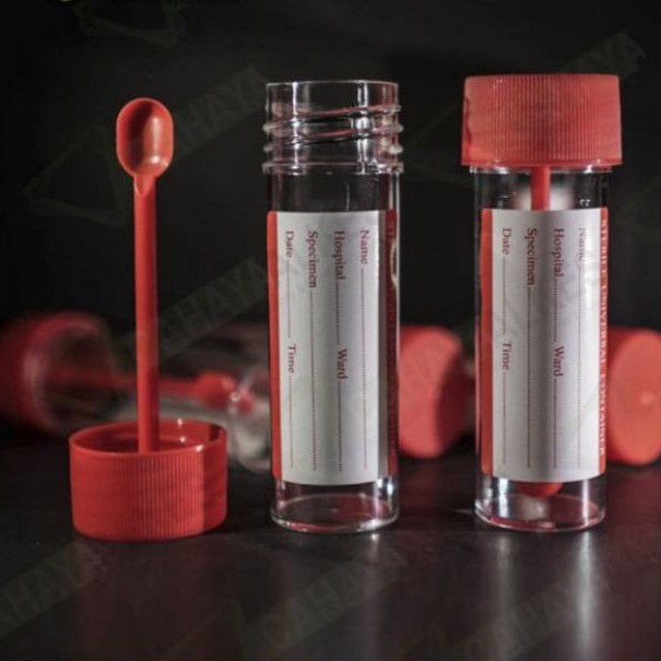 Jual pot feses transparant bersendok 30 cc feaces feces | Shopee Indonesia