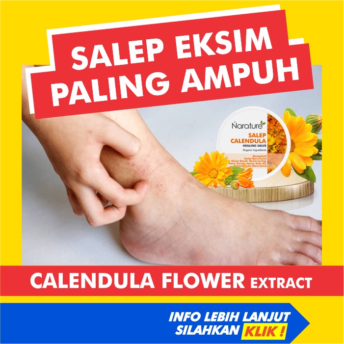 Jual Narature Salep Obat Gatal Eksim Calendula Salve Kulit Gatel Exim ...