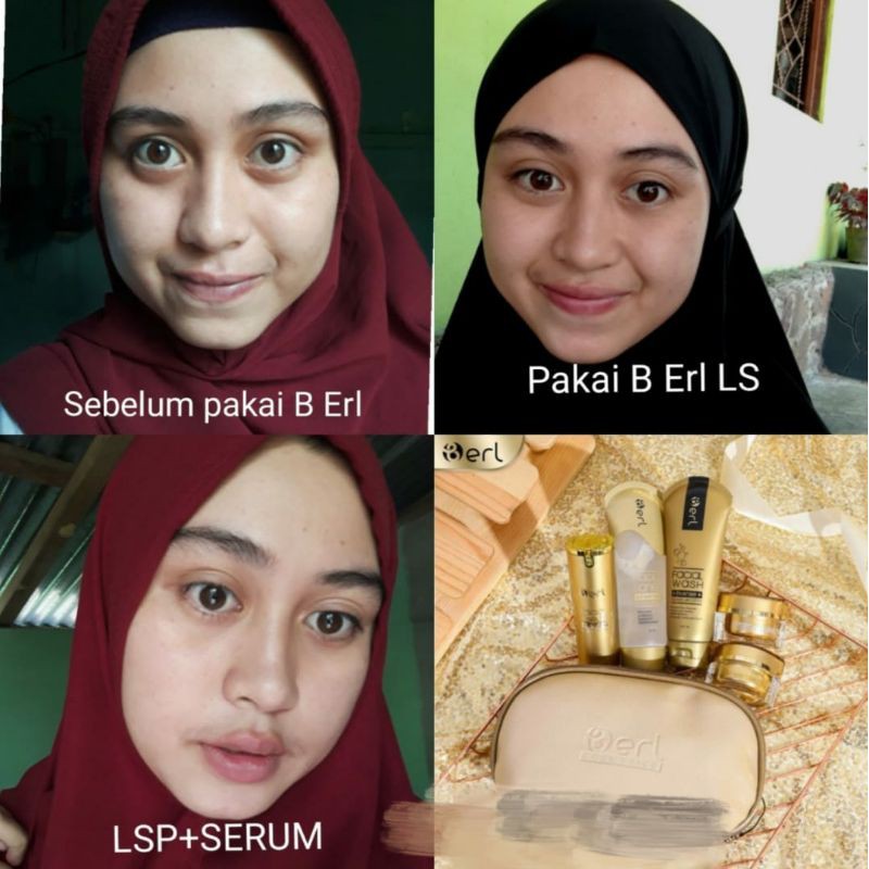 Jual BERL INTENSE LIGHTENING SERIES (LS) | Shopee Indonesia
