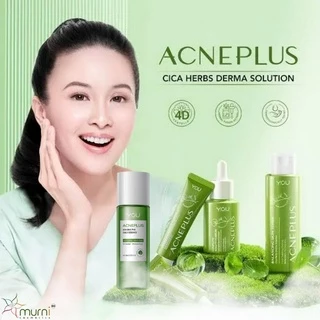 Jual You Acne Terlengkap & Harga Terbaru April 2024 | Shopee Indonesia