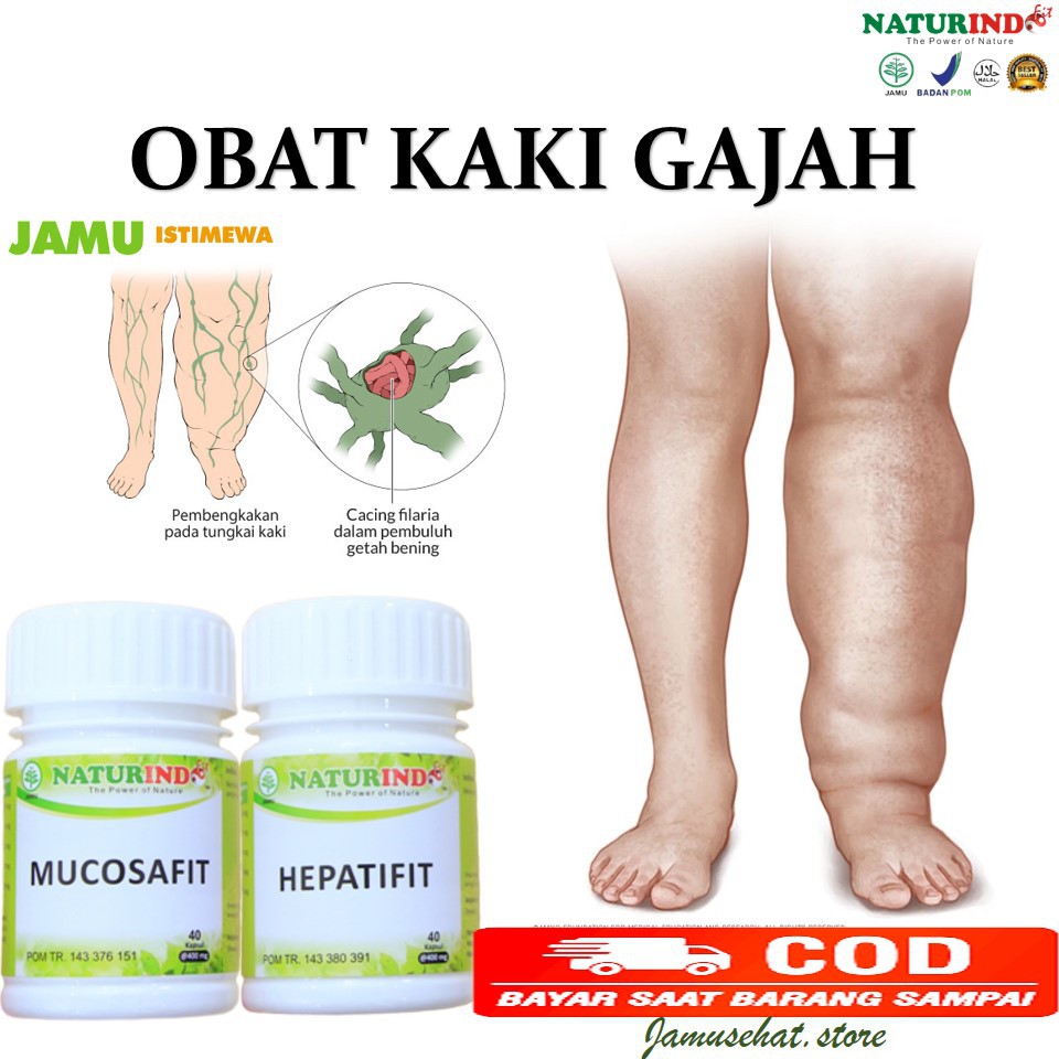 Jual Obat Kaki Gajah Tungkai Bengkak Infeksi Filariasis Herbal Paling ...