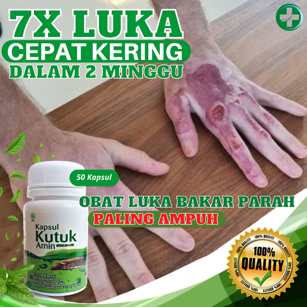 Jual TERLARIS!! Obat Penghilang Bekas Luka Bakar / Koreng / Bopeng ...