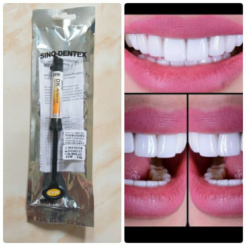 Jual Composite Dentex Anterior XW dan Esthetica EXW Use Veneer Gigi 4gram Kemenkes RI AKL ...