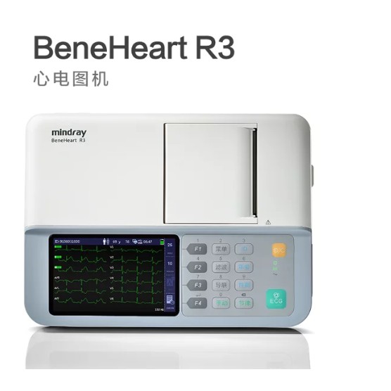 Jual EKG 3 channel R3 ECG 3 channelwith interpretation | Shopee Indonesia
