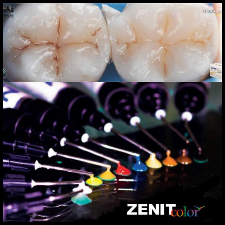 Jual Composite Staining Zenit Color Flow Untuk Karakteristik Penambalan ...