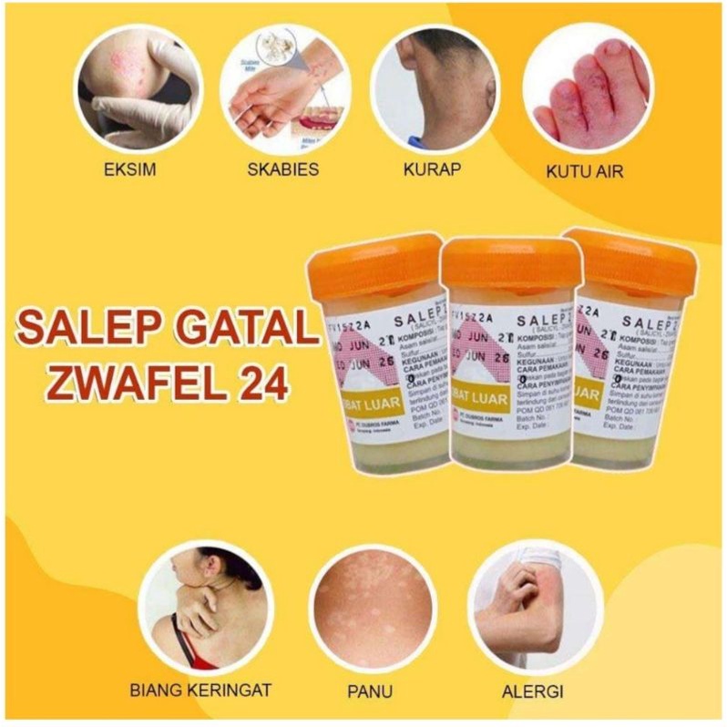 Jual SALEP GATEL ZWAFEL 24 ORIGINAL Obat Salep Gatal Paling Ampuh Gatel ...