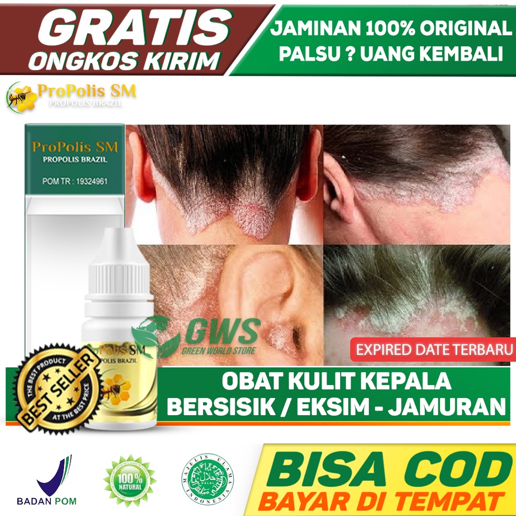Jual Obat Kulit Kepala Bersisik - Jamuran Jamur Cair - Kulit Kering - Psoriasis - Ketombe ...