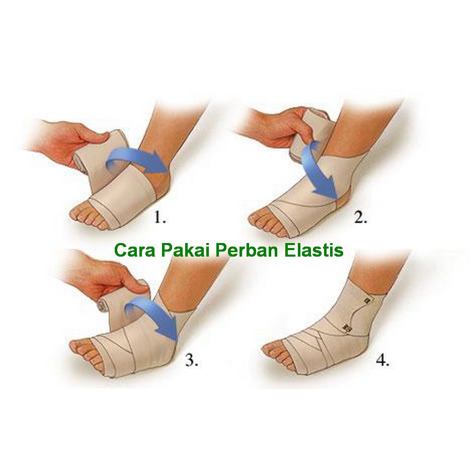 Jual Perban Elastis 6 " High Elastic Bandange 15cmx4,5m - General Care ...