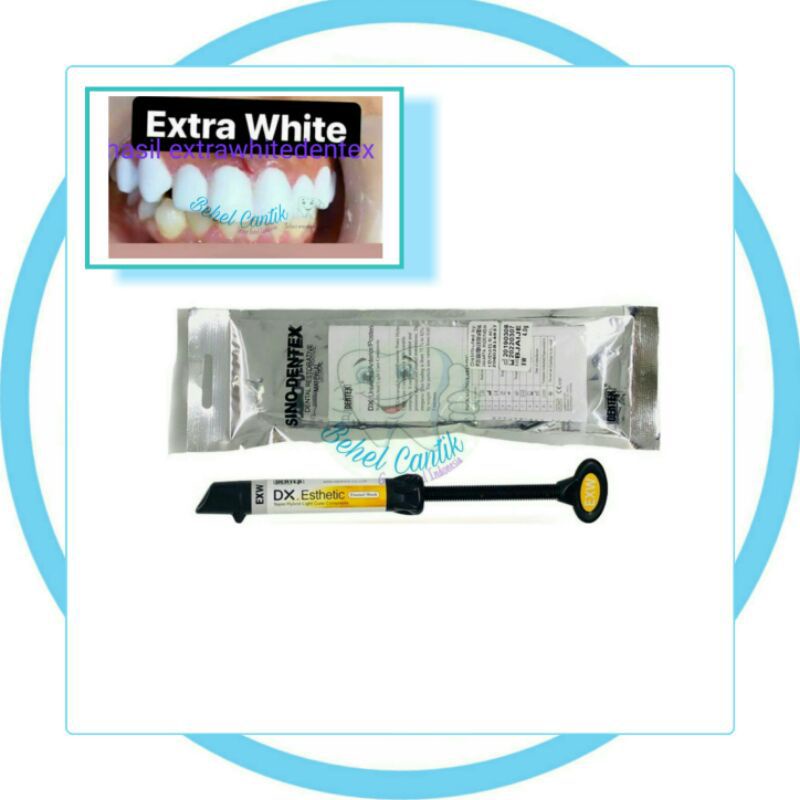 Jual Dentex Composite Extrawhite Anterior | Shopee Indonesia