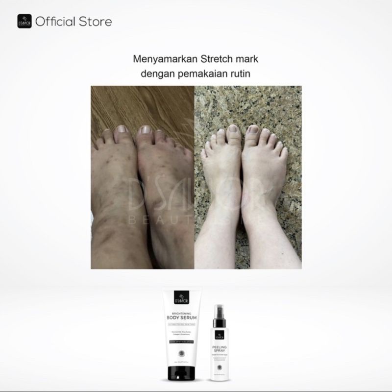 Jual D'SAVIOR Glow Up Series ( Brightening Body Serum & Peeling Spray ...