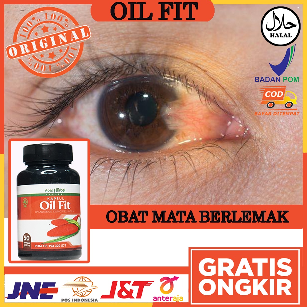 Jual Obat Alami Mata Berlemak Mata Pterygium Pembersih Lemak Mata ...