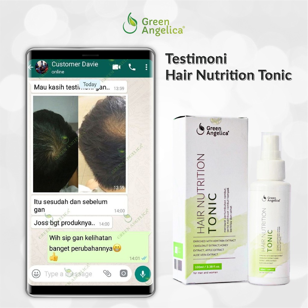 Jual Hair Tonic Green Angelica | Obat Rambut Rontok Parah | Mengatasi ...