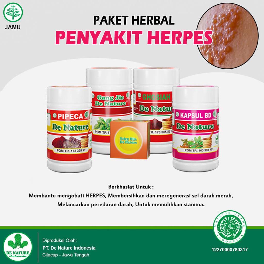 Jual Obat Cacar Api ( Herpes ) Alami | Shopee Indonesia