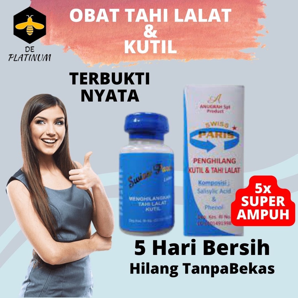 Jual ORIGINAL Lotion Swiss Paris Obat Penghilang Kutil & Tahi Lalat ...