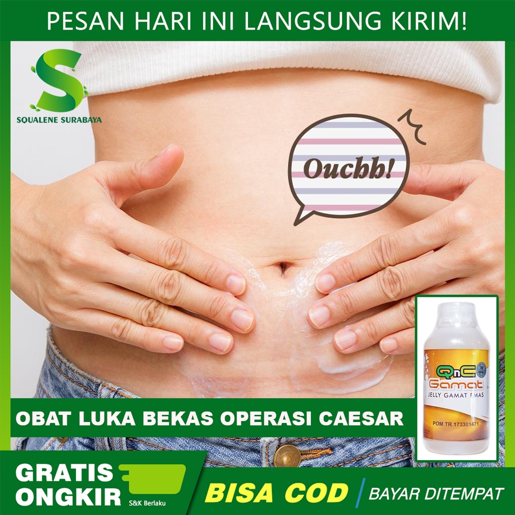Jual Obat luka Bekas Operasi Caesar & Operasi Bedah - Obat Pengering ...