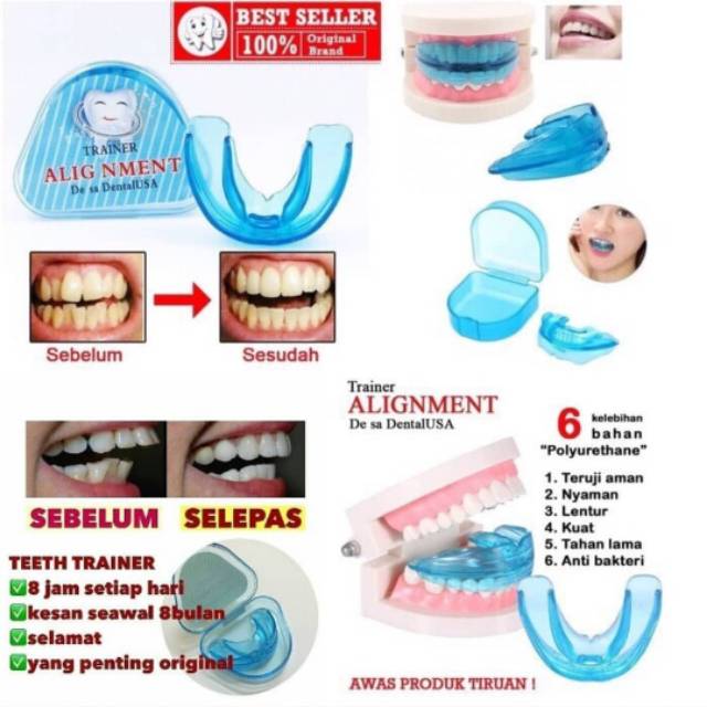Jual PERAPI GIGI TEETH TRAINER RAPATKAN GIGI TONGGOS RENGGANG JARAK ...