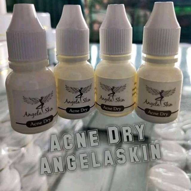 Jual Acne dry angela skin acne solution totol jerawat | Shopee Indonesia