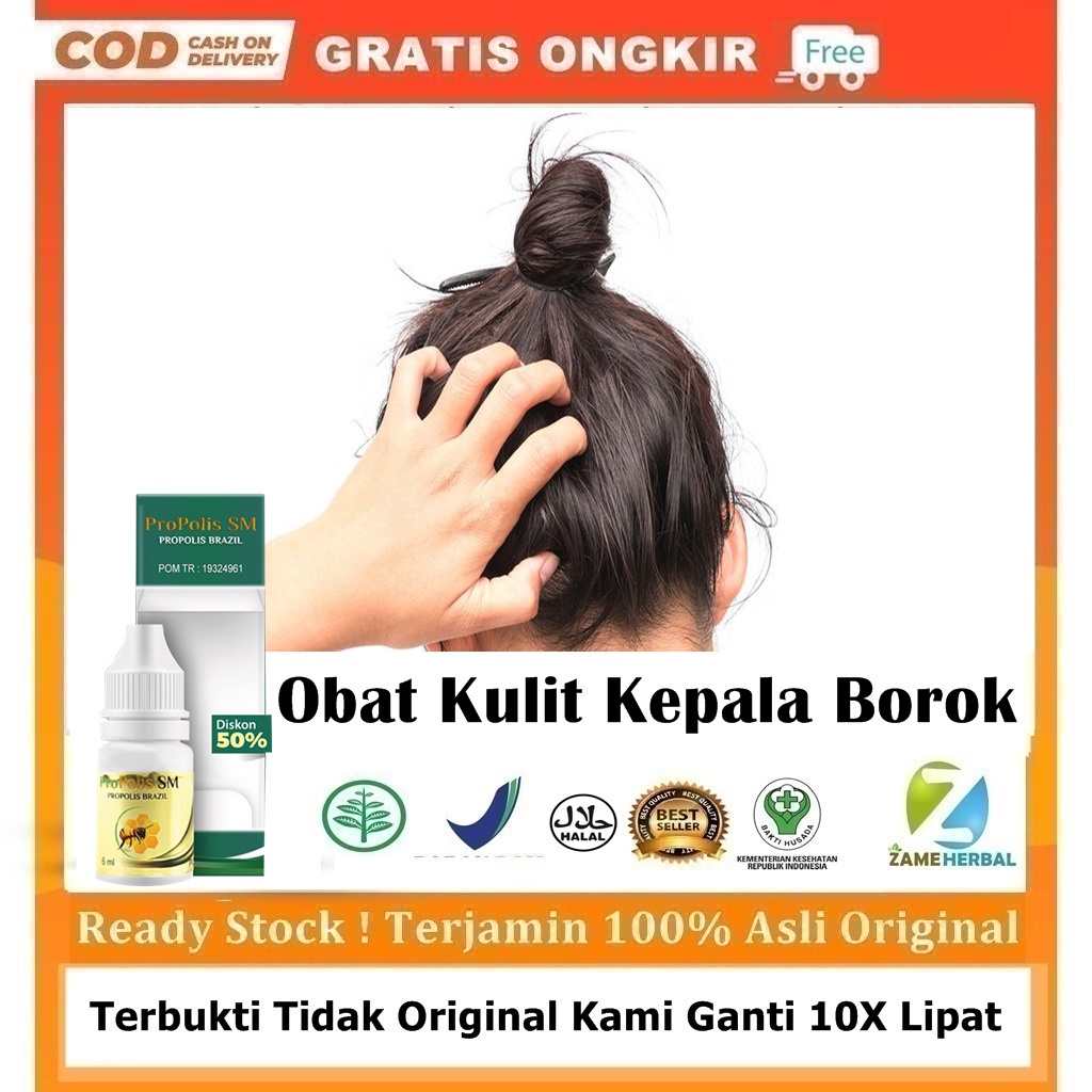 Jual Obat Kulit Kepala Borok, Bersisik, Menebal, Mengelupas, Kurap, Obat Kepala Gatal Gatel ...