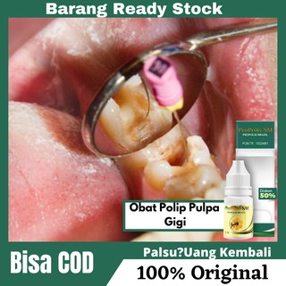 Jual Obat Polip Pulpa Gigi , Polip Di Gusi , Gusi Bengkak Dan Bernanah ...