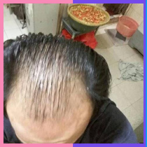Jual Finas Teride 1 Mg Isi 30 Capsul Perawatan Kebotakan Pria Karena ...