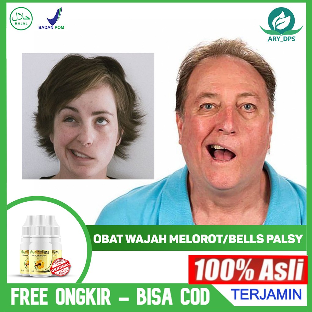 Jual Obat Bells Palsy - Stroke Muka - Wajah Melorot - Muka Kaku Herbal ...