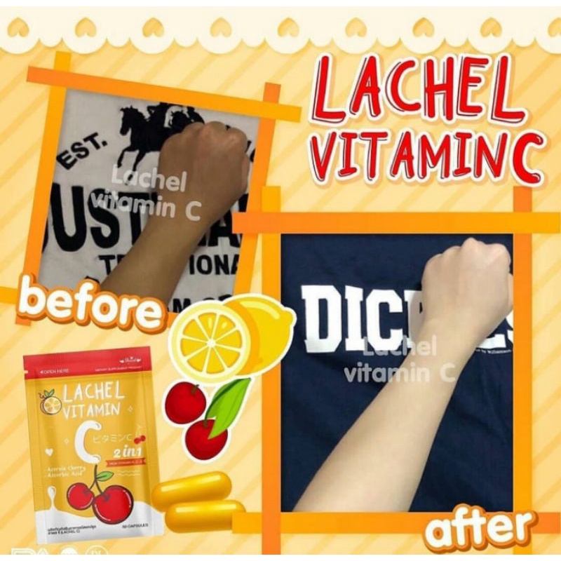 Jual lachel vit c 100% original by skynest thailand | Shopee Indonesia