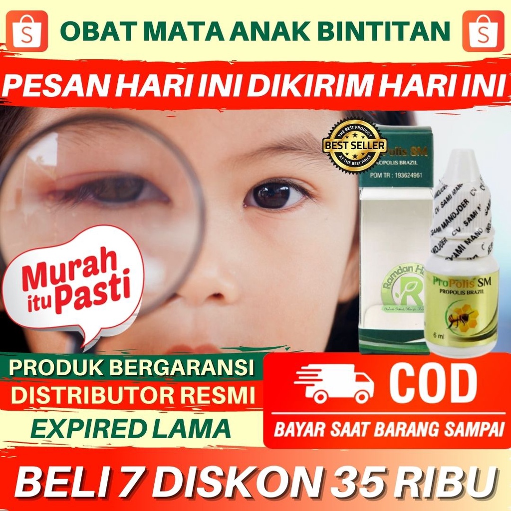 Jual Obat Mata Bintitan Pada Anak / Obat Bintitan Untuk Anak / Bisul ...