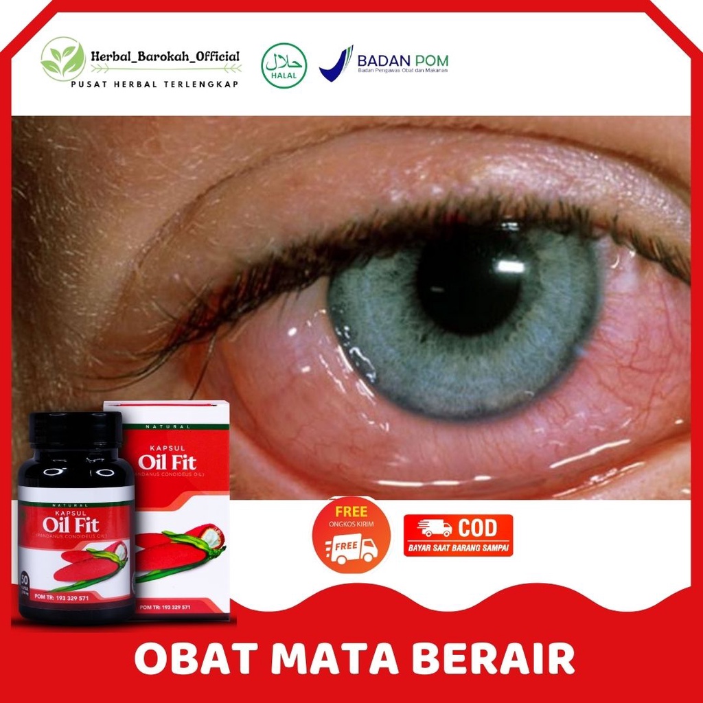 Jual Obat Mata Berair - Gatal - Perih - Iritasi Mata - Panas - Mata ...