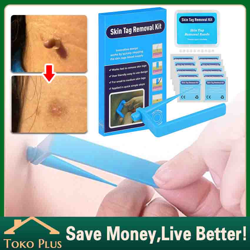 Jual 31Pcs Skin Tag Rubber Band Removal Tool Kit Skin Tag Mole Wart ...