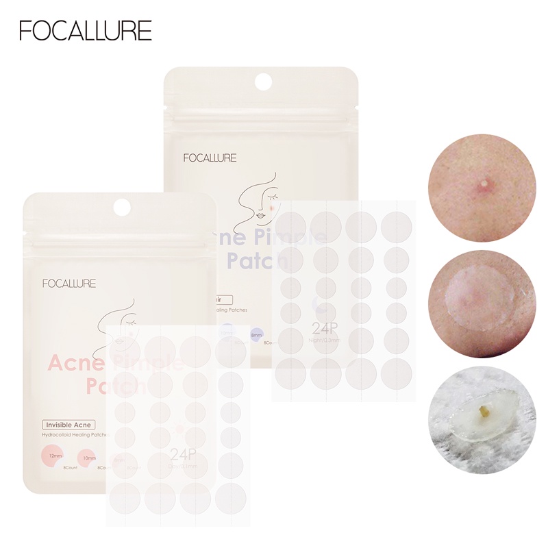 Jual FA186 Focallure Pimple Patch ORIGINAL BPOM / Stiker Jerawat Day Night | Shopee Indonesia