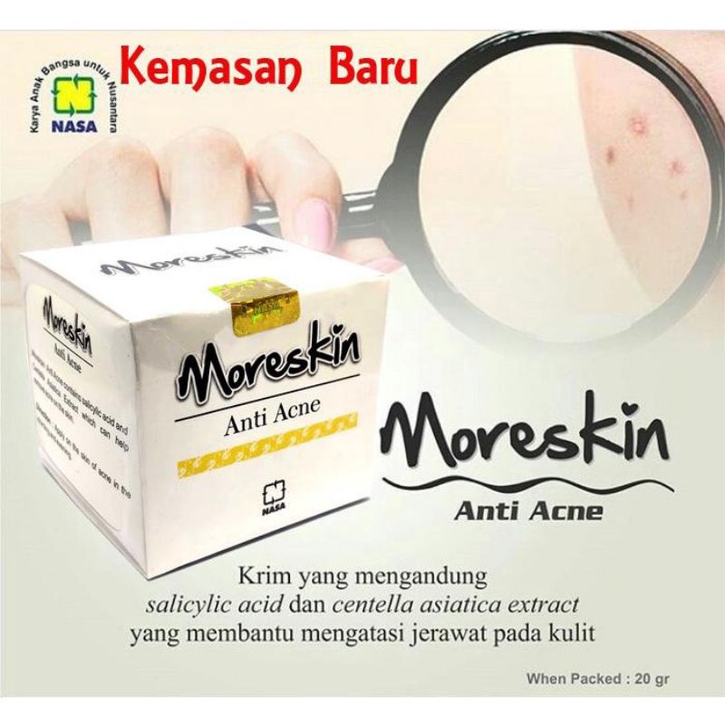 Jual Moreskin Anti Acne NASA Original Cream Untuk Jerawat XACNE | Shopee Indonesia