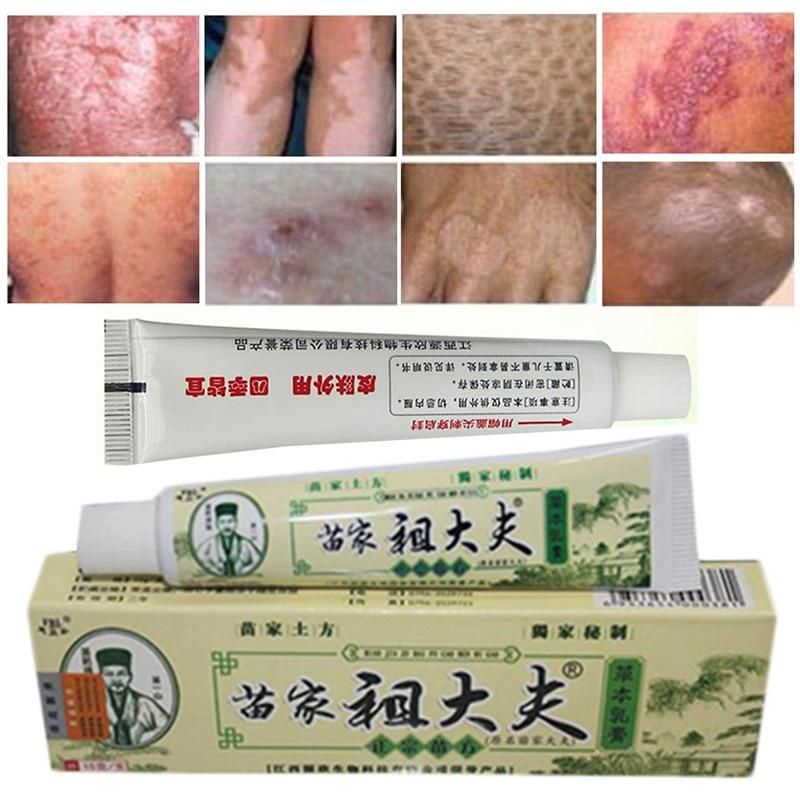 Jual Zudaifu salep cream luka kulit eksim jamur kurap gatal psoriasis ...