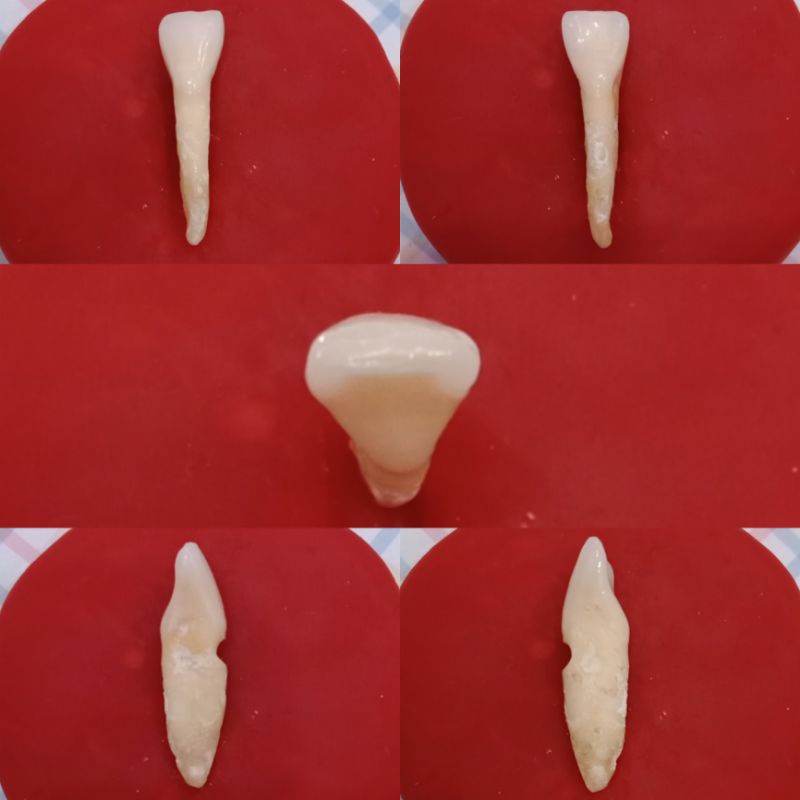 Jual Gigi 42 Gigi Asli Praktikum Gigi Insisif Lateral Kanan Rahang ...