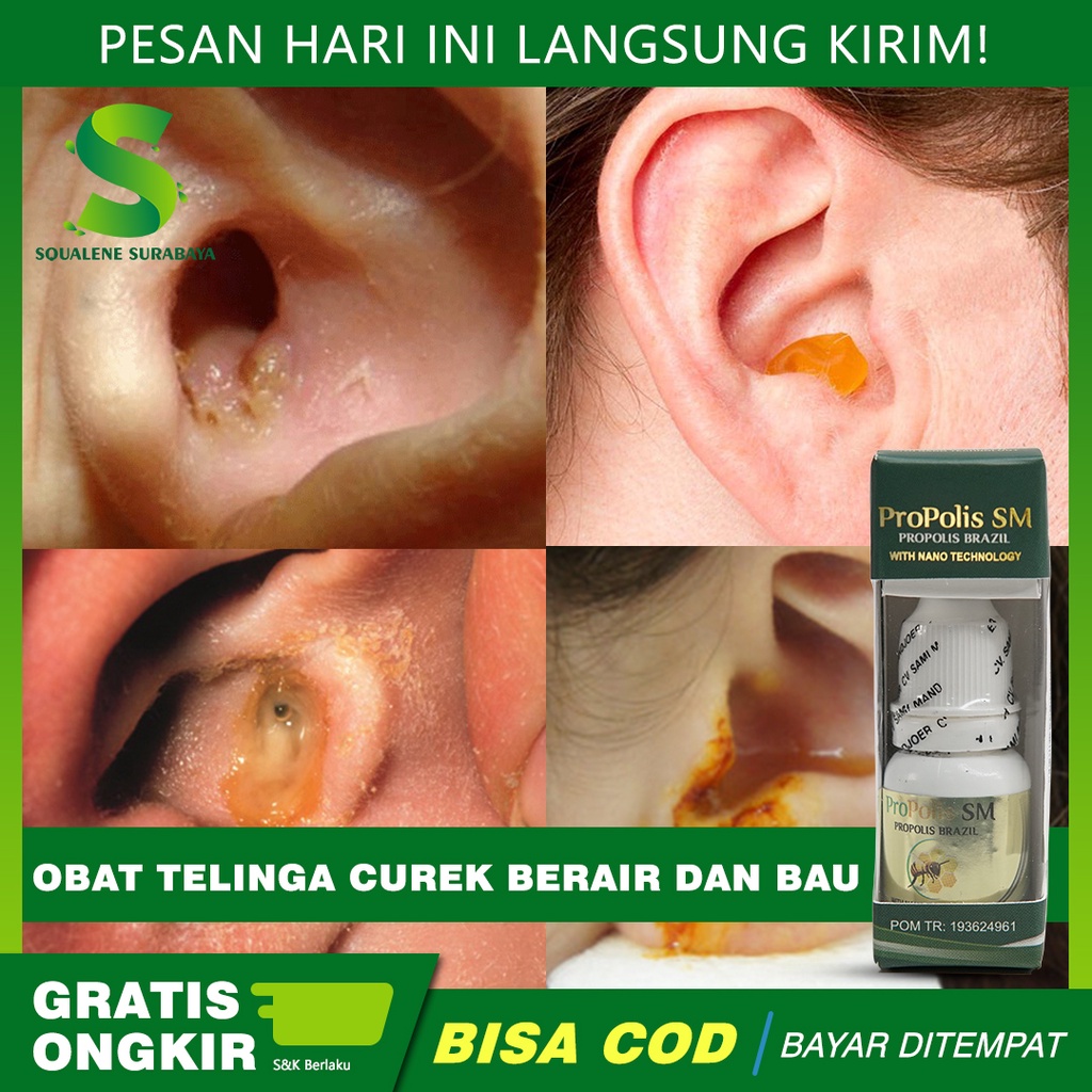 Jual Obat Telinga Curek Berair dan Bau - Telinga Congek - Gendang Telinga Robek - Infeksi ...
