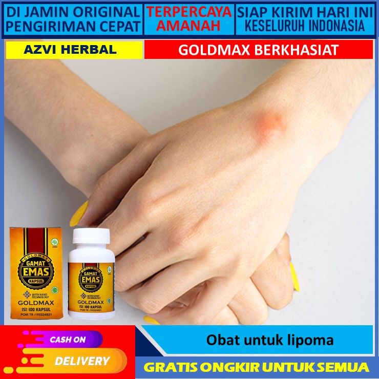 Jual obat lipoma obat benjolan lipoma Obat benjolan lemak (Lipoma ... Jual obat lipoma obat benjolan lipoma Obat benjolan lemak (Lipoma ...