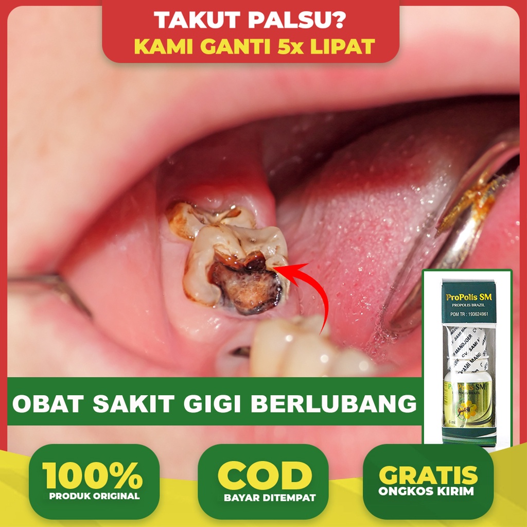 Jual Obat Sakit Gigi Berlubang, gigi Bengkak Nyut Nyutan, Obat Tetes ...