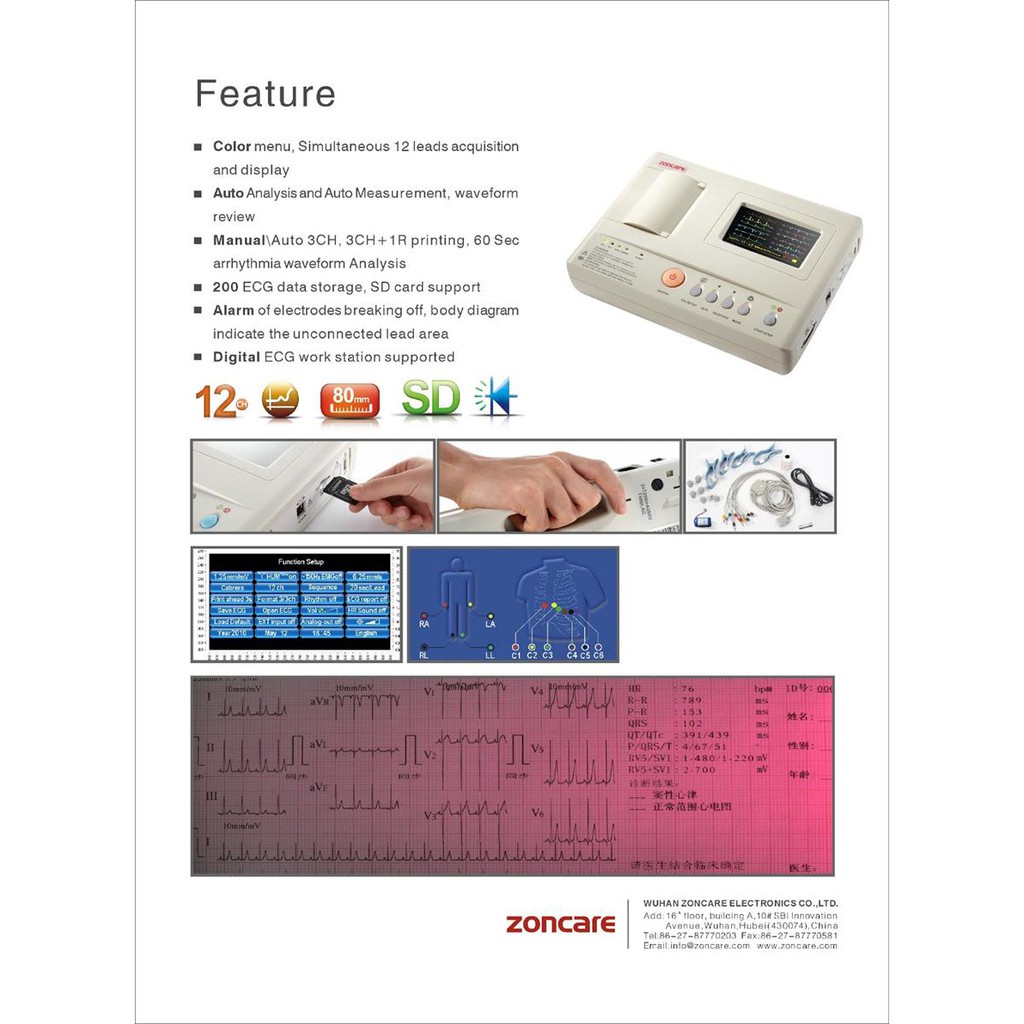 Jual ecg zonecare ZQ-1303G,ekg 3 channel ZQ-1303G | Shopee Indonesia