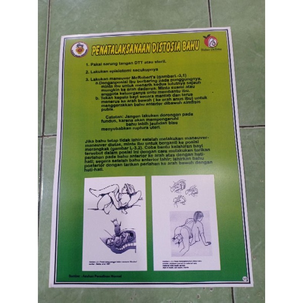 Jual (13) POSTER PENATALAKSANAAN DISTOSIA BAHU | Shopee Indonesia